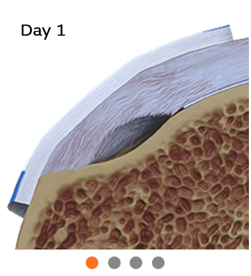 Regeneten LP - RediscoverYourGo with Smith & Nephew